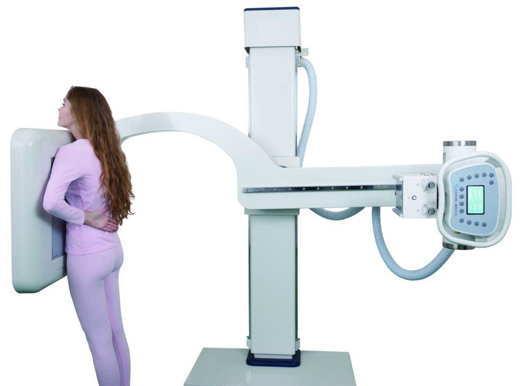 Mengenal Alat Medis X Ray Film - News Cipta Medika Indonesia